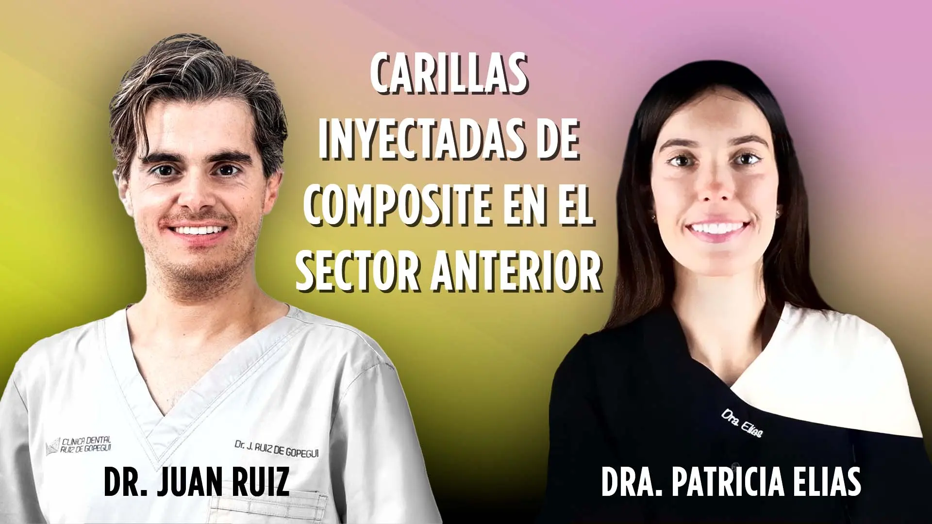 Carillas Inyectadas de Composite en el Sector Anterior | Autrán Dental ...